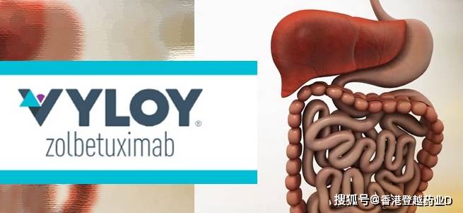 FDA批准 Vyloy 用于治疗胃癌和胃食管连接处癌_患者_化疗_检测