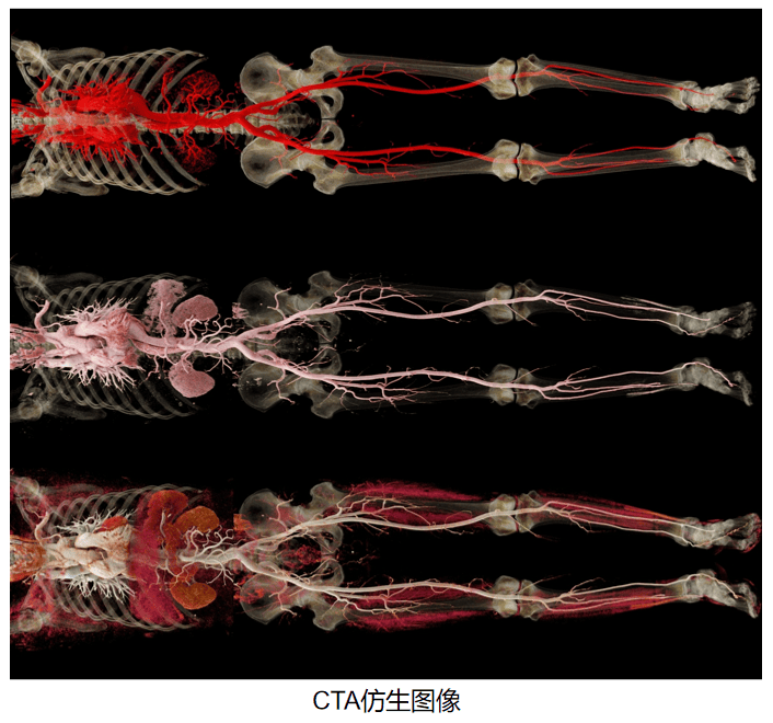 揭秘血管成像黑科技——MRA、CTA、DSA的区别_技术_检查_疾病诊断